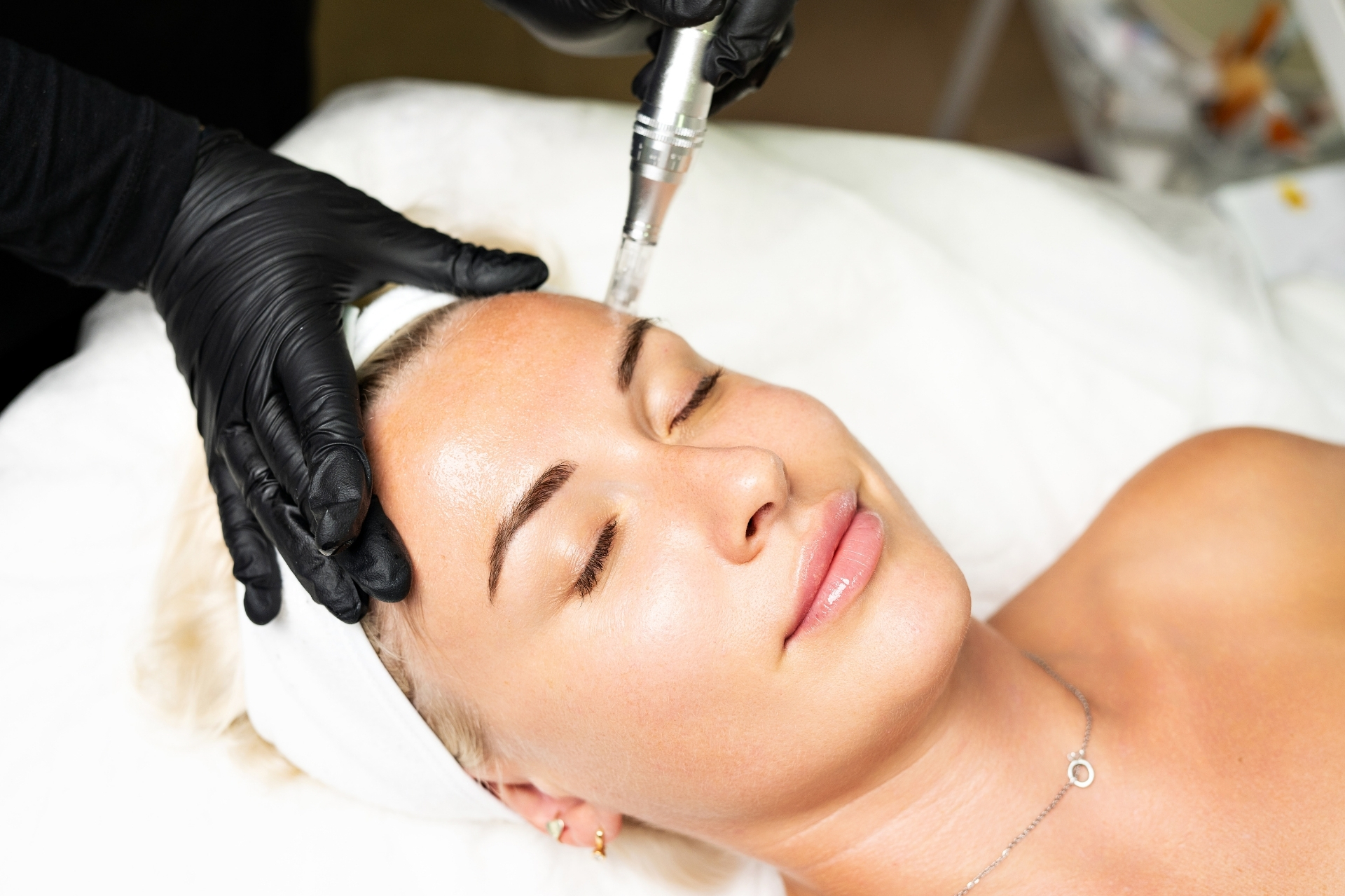 Microneedling Facial | Boost Collagen for Youthful Skin